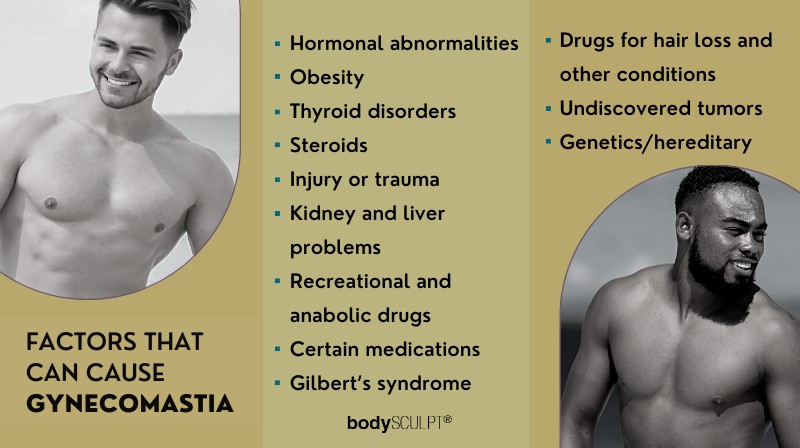 Factors That Cause Gynecomastia